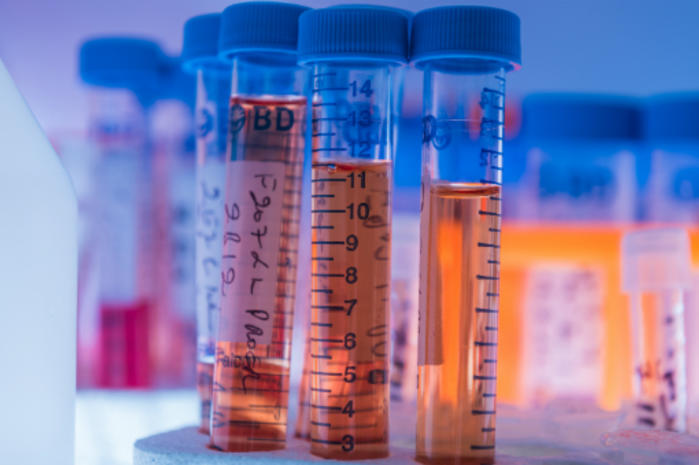 Sinemet CR Discontinued but Other Options Available | Parkinson's Disease