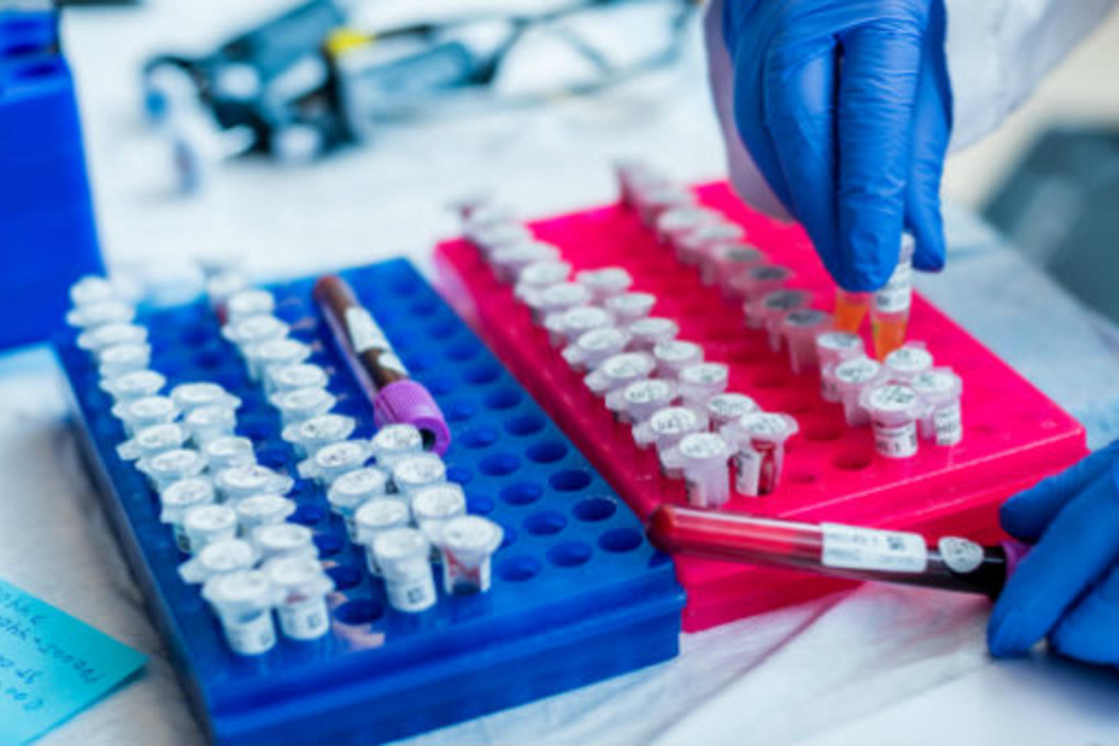 Blood Test for Alzheimer’s Could Preview Similar Test for Parkinson’s ...