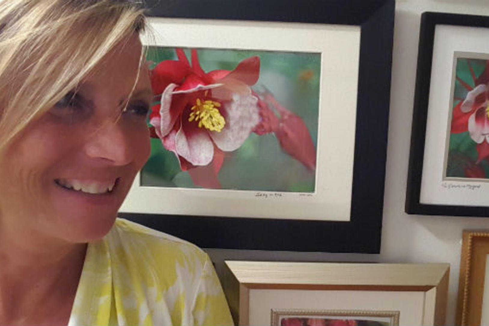 My Journey with DBS: Wired up, Tuned in and Turned on | Parkinson's Disease