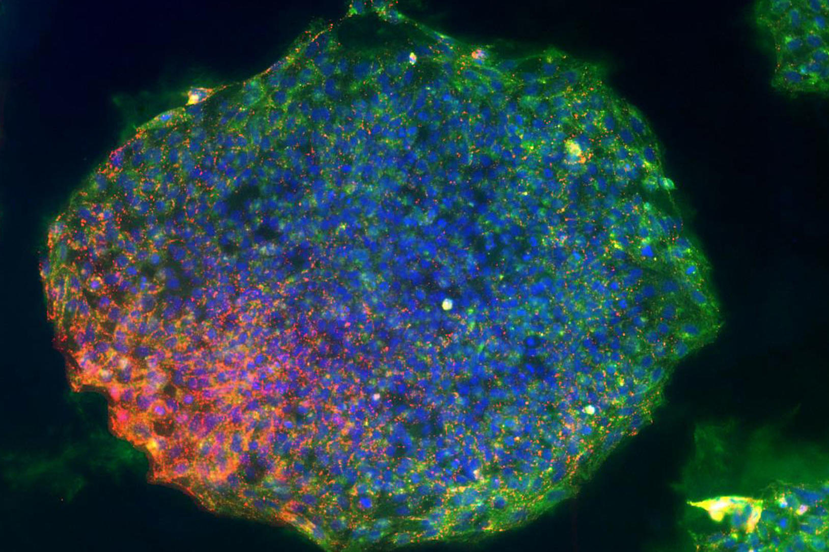 iPS Cells Show Individualized Response to Parkinson’s Disease ...