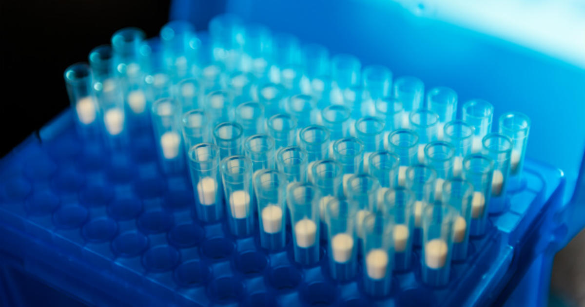 Data from Landmark MJFF Study Shows Impact of Promising Parkinson’s ...