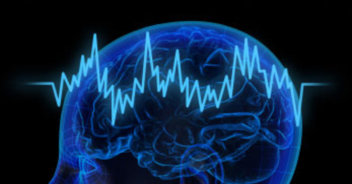 Recording Brain Activity Could Lead to Personalized Deep Brain ...