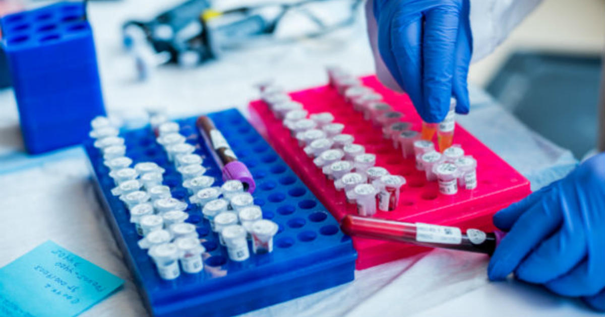 Blood Test May Help Confirm Parkinson's Diagnosis | Parkinson's Disease