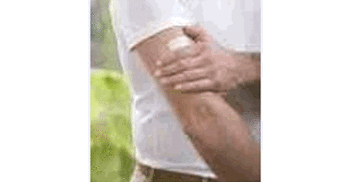 Breaking: Neupro Patch approved by U.S. FDA for Parkinson's Disease and ...